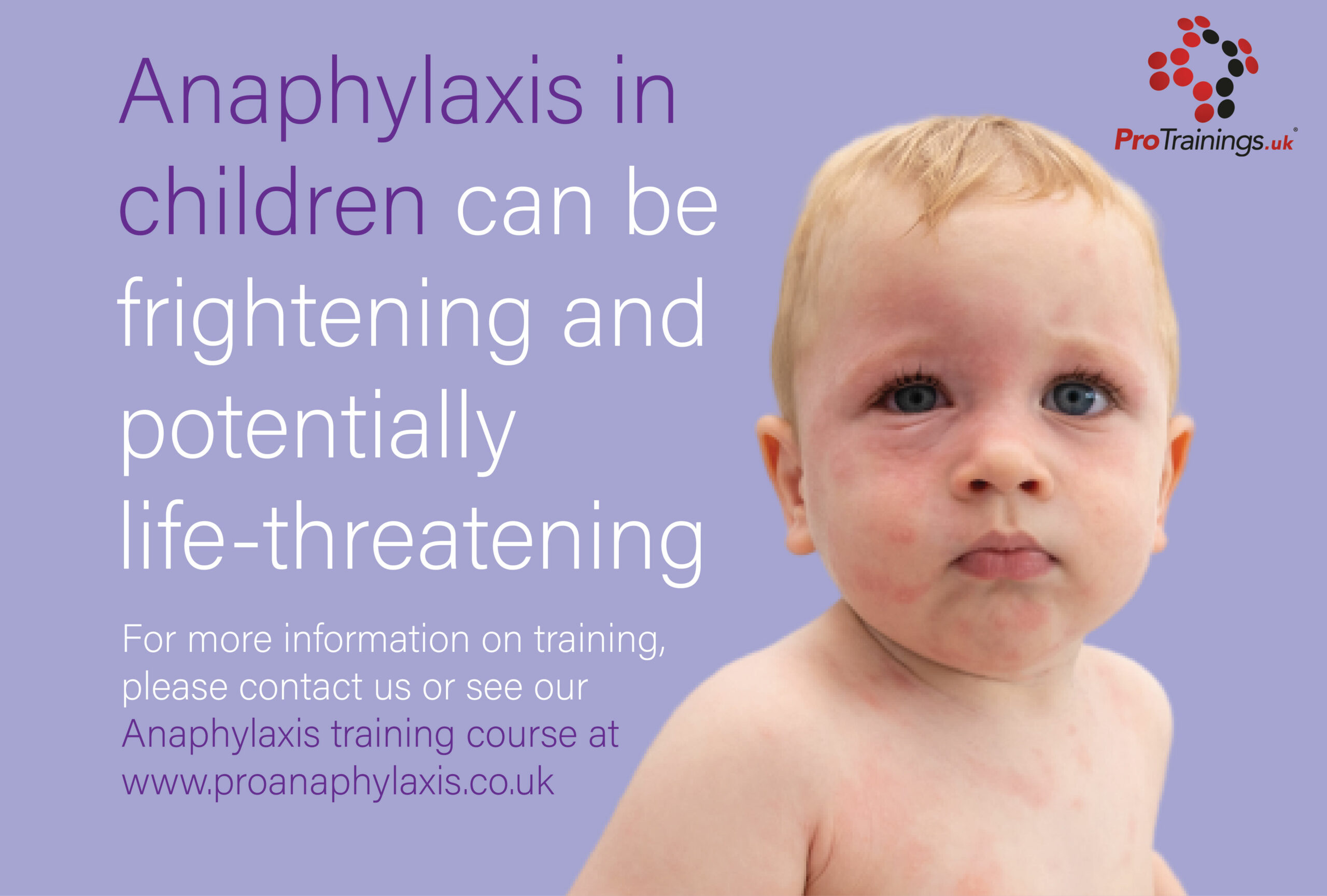 Anaphylactic reactions in children
