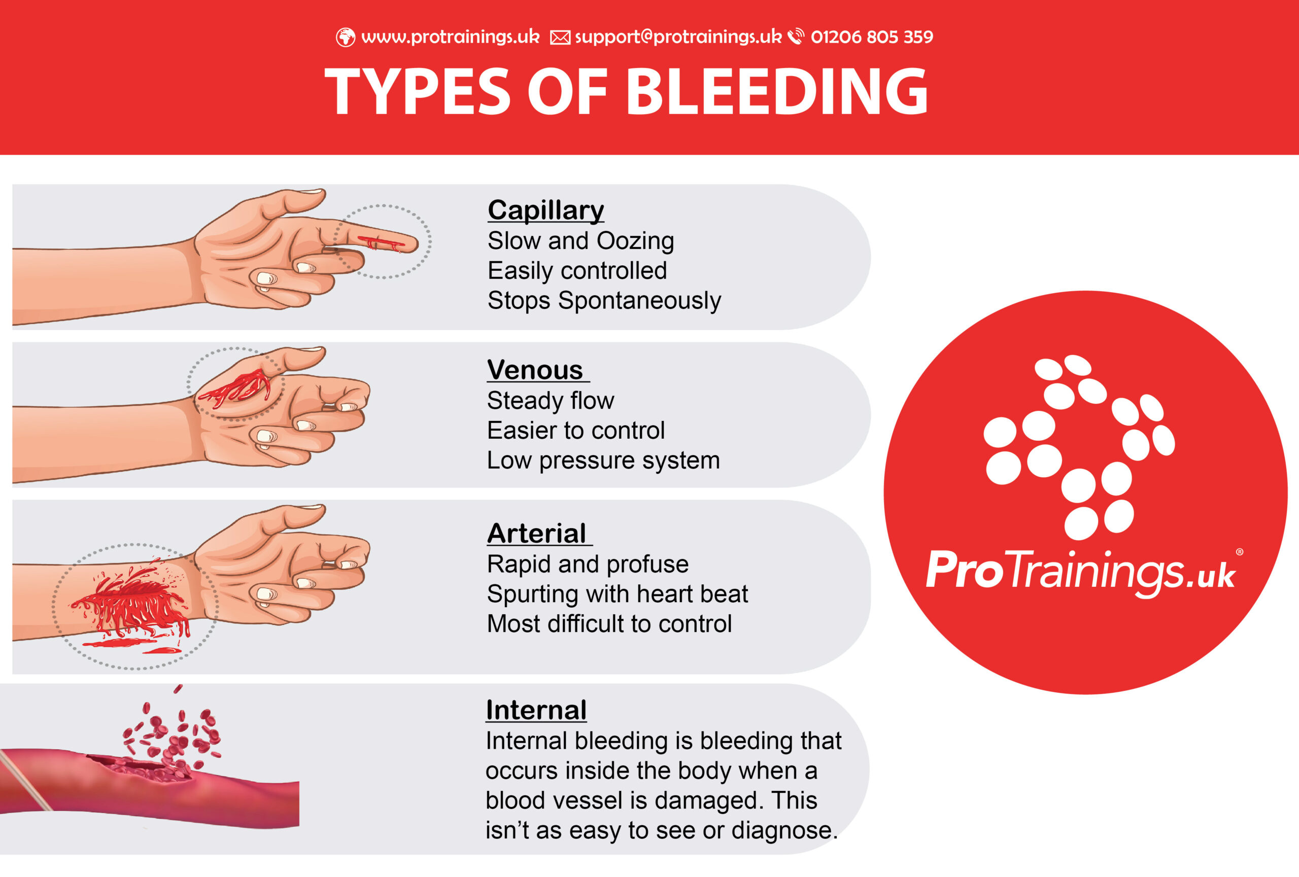 What are the main types of bleeding?