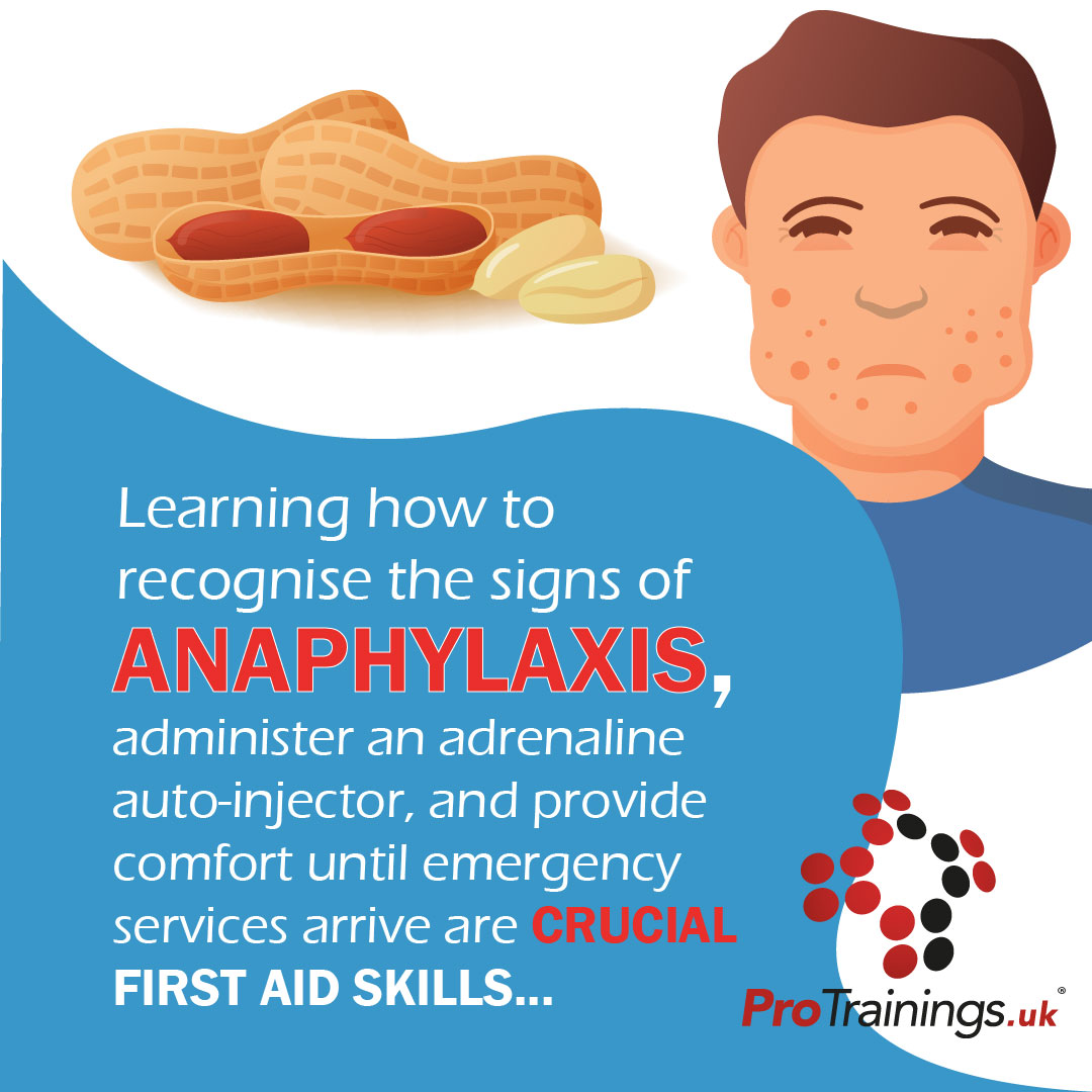 Dealing with Allergic Reactions: First Aid for Anaphylaxis