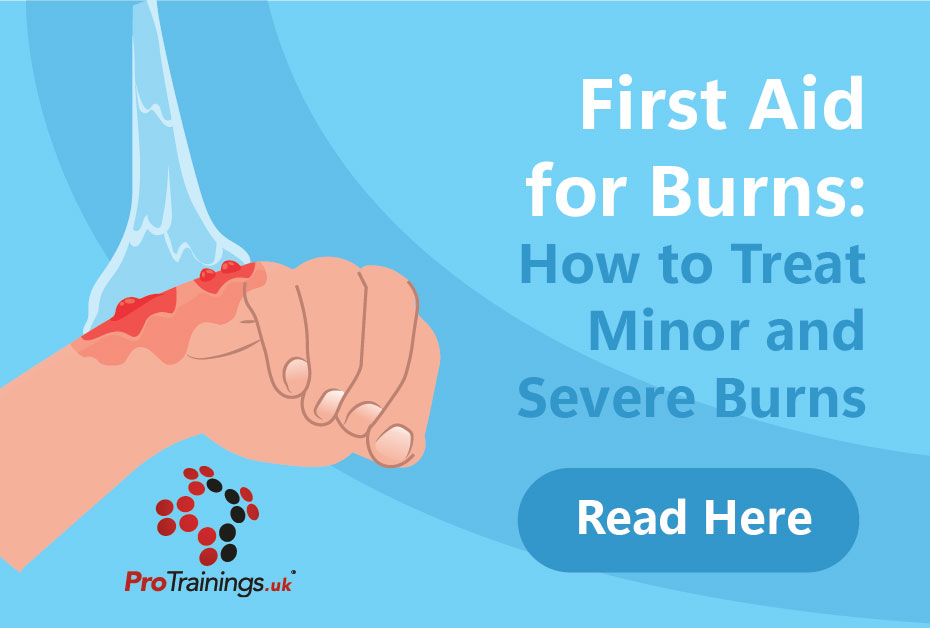 First Aid for Burns: How to Treat Minor and Severe Burns