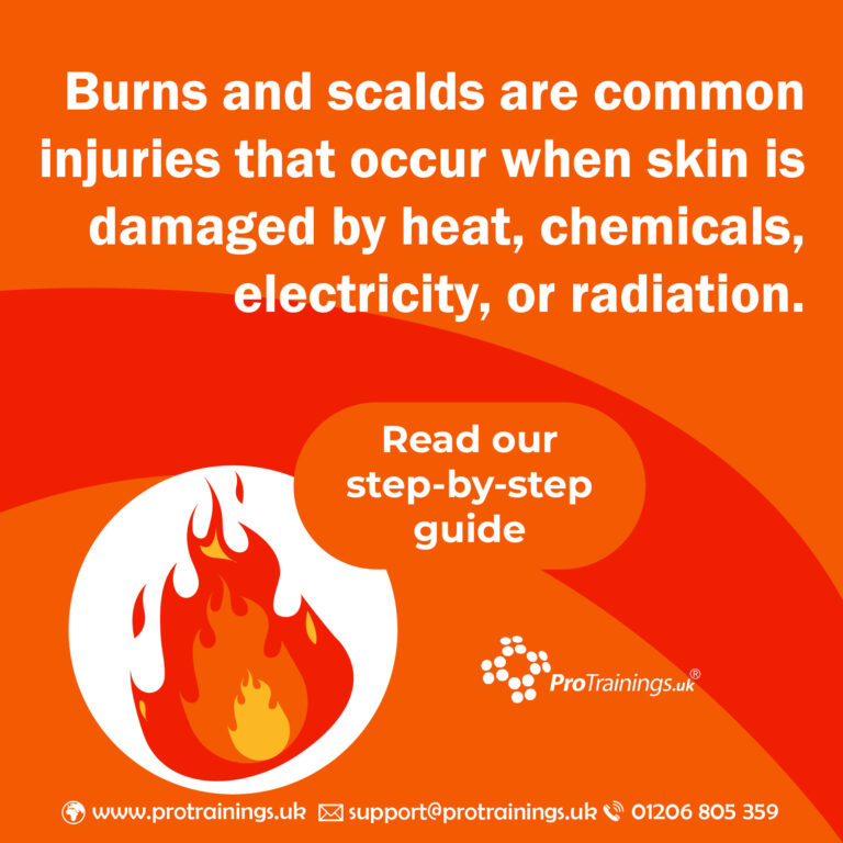 Burns and Scalds: How to Treat and Manage Burn Injuries - Online Health ...