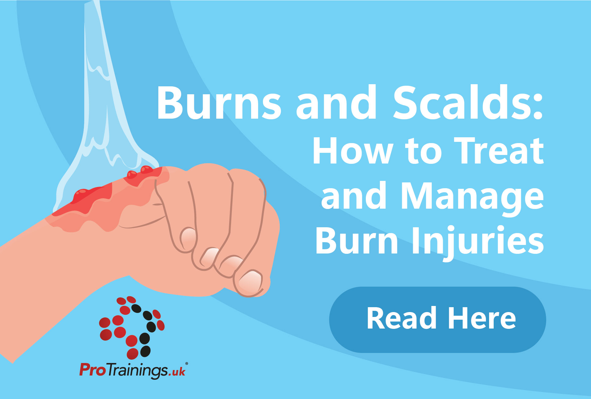 Burns and Scalds: How to Treat and Manage Burn Injuries - Online Health & Safety Training ...