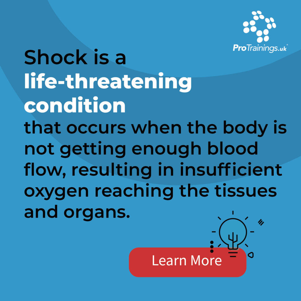 Shock: How to Recognise and Provide First Aid for Shock - ProTrainings ...