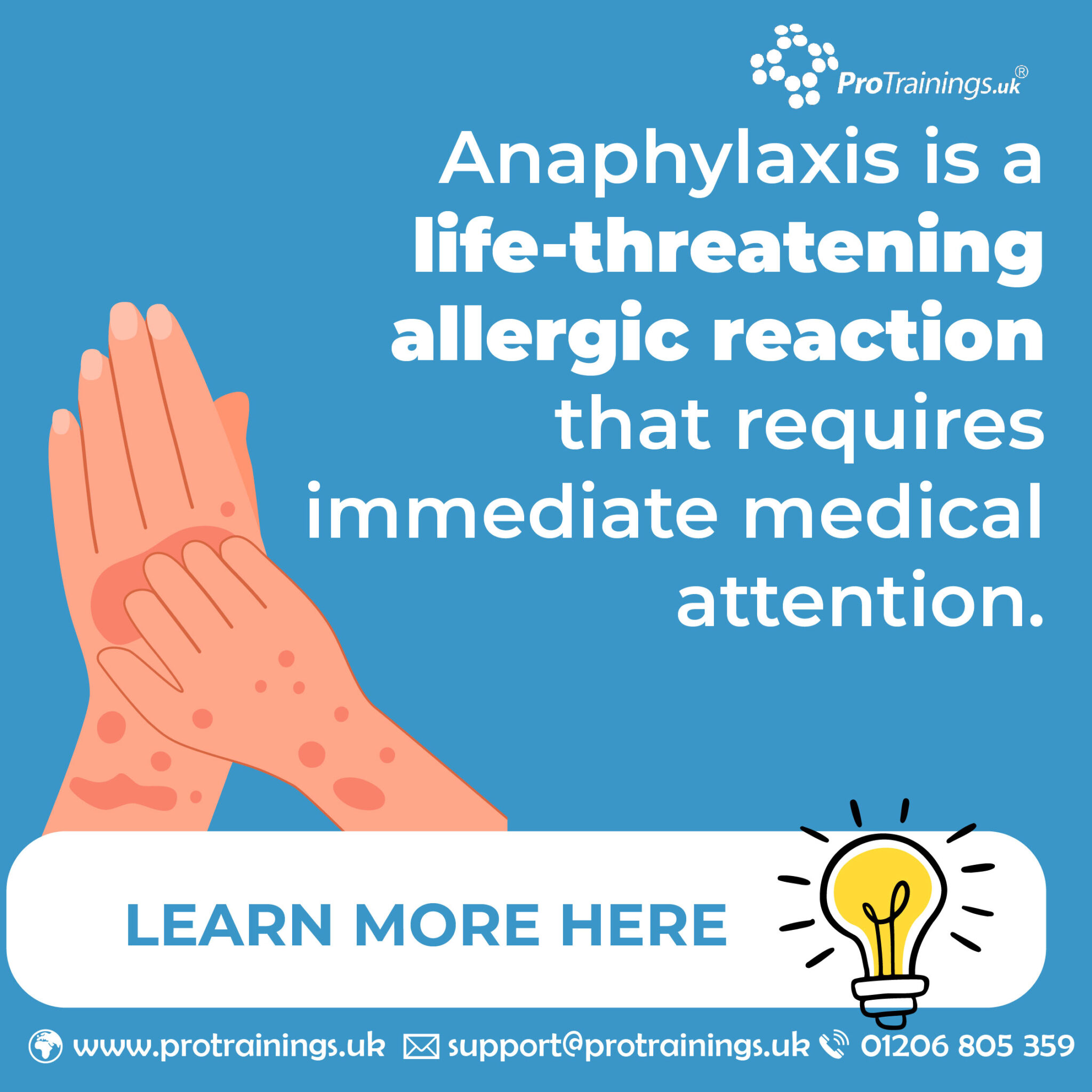 Anaphylaxis - Severe Allergic Reactions - ProTrainings Europe
