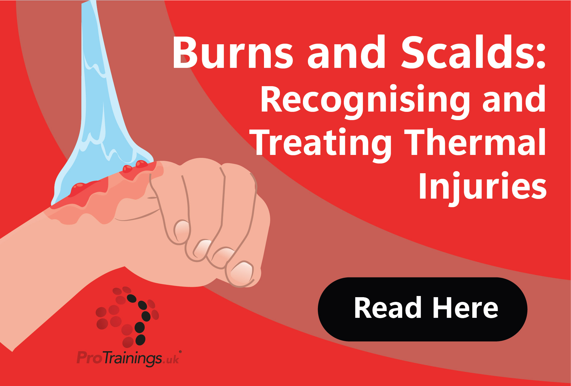 Burns and Scalds: Recognising and Treating Thermal Injuries - Online Health & Safety Training ...